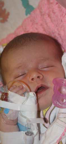 More on Pertussis | Seattle's Child